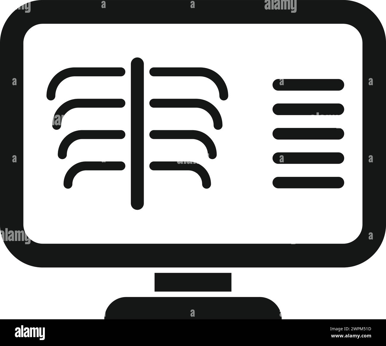 Image thorax icon simple vector. Person examination. Ward clinic beam ...