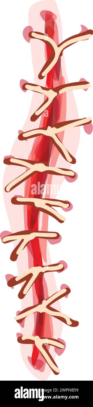 Tool suture icon cartoon vector. Care aid body. Anatomy sewing ...