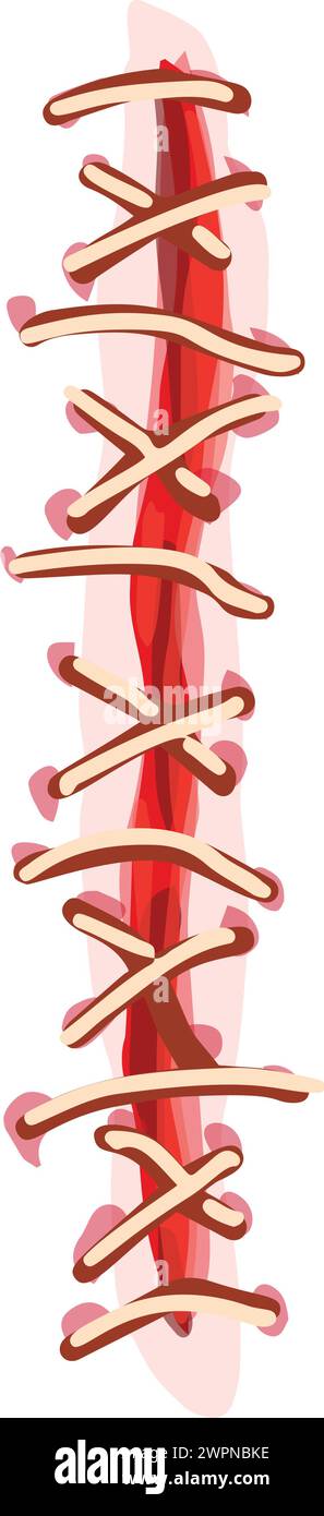 Metal body suture icon cartoon vector. Care aid anatomy. Treatment ...