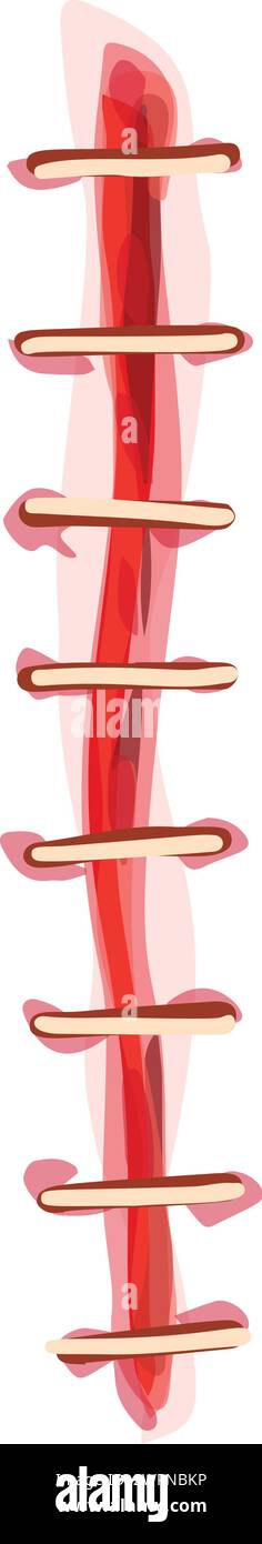 Medicine suture icon cartoon vector. Seam body surgery. Health care aid ...