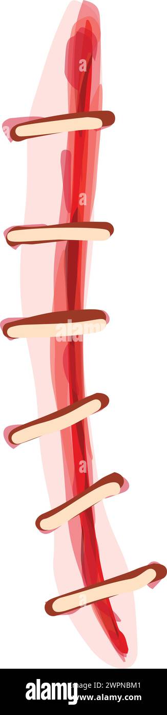 Medical suture icon cartoon vector. Metal body care. Anatomy room ...