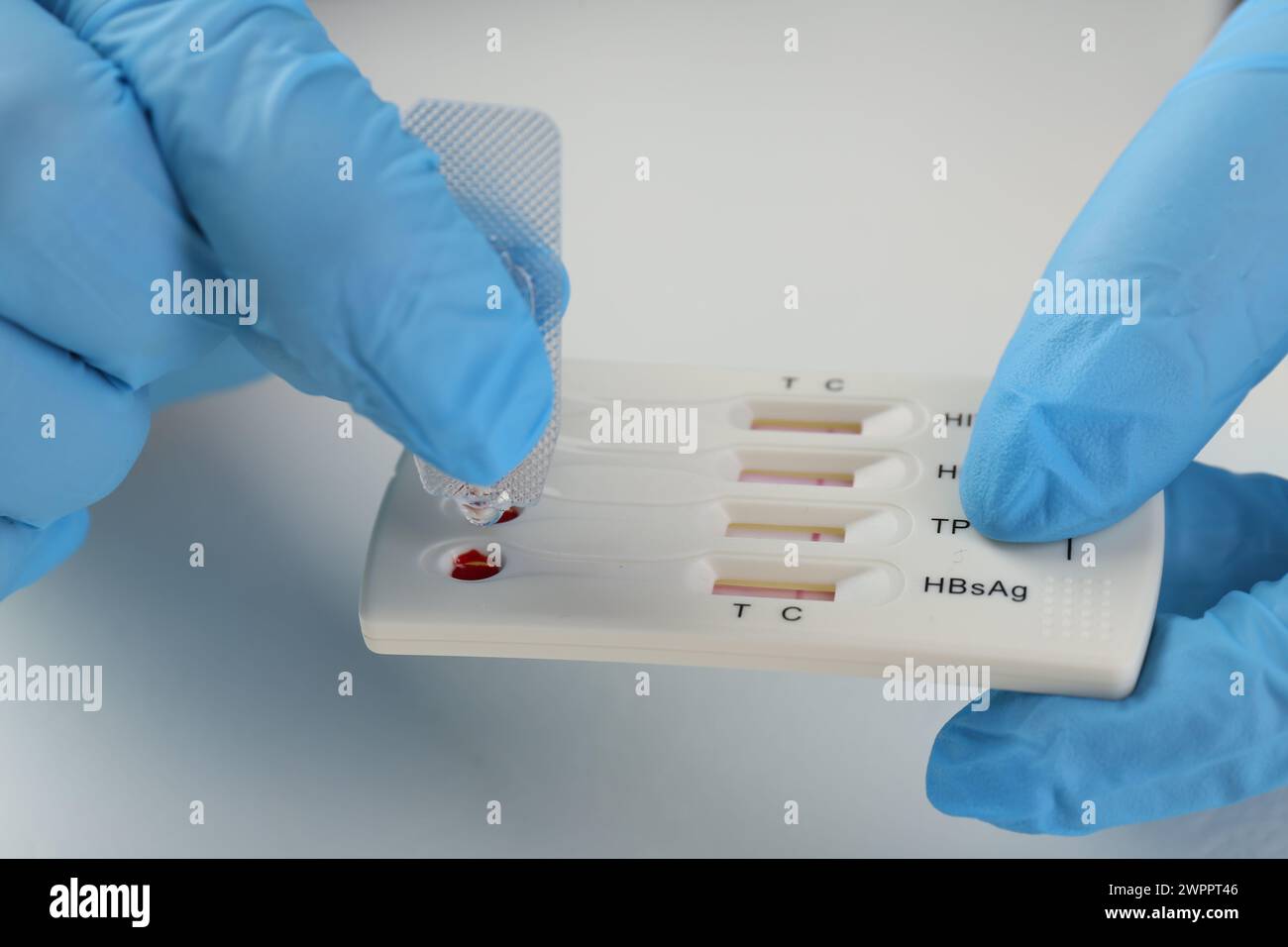 Doctor dropping buffer solution onto disposable multi-infection express ...