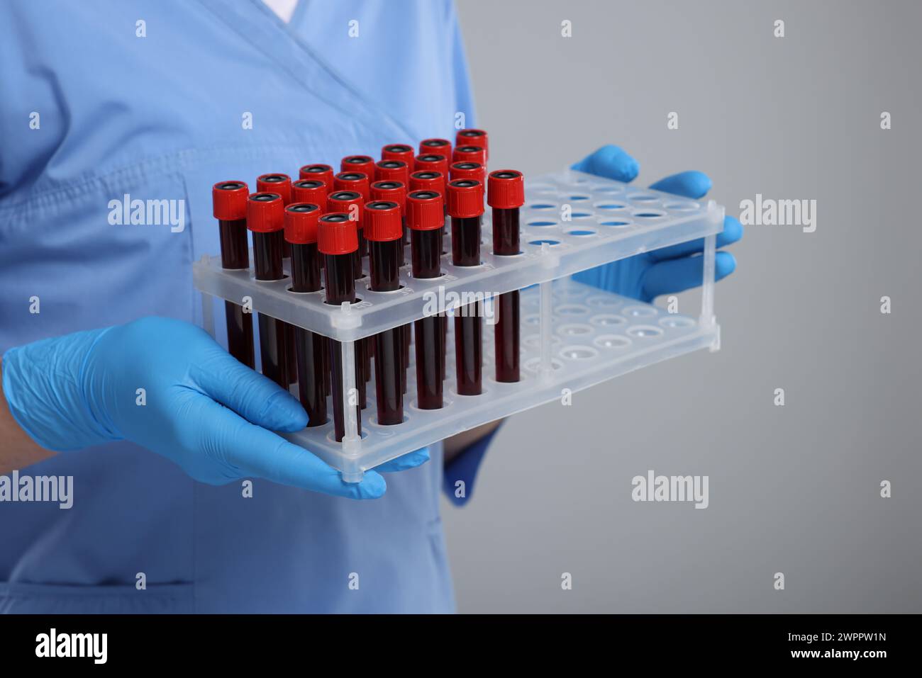 Laboratory testing. Doctor with blood samples in tubes on light grey ...