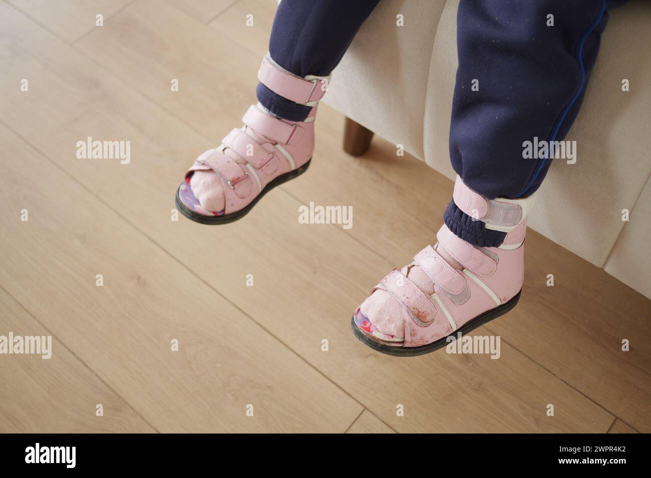 Child cerebral palsy disability with legs orthosis. shoes in her feet ...