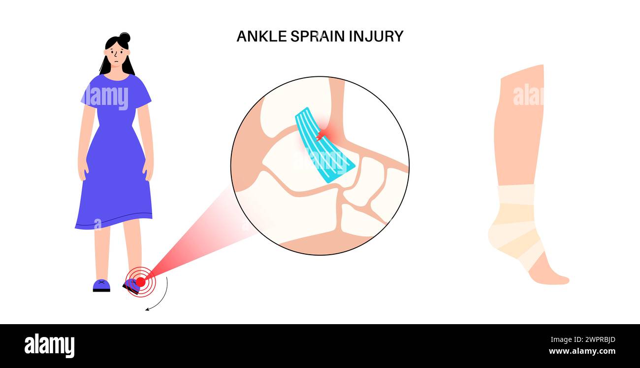 Ligament diagram hi-res stock photography and images - Alamy