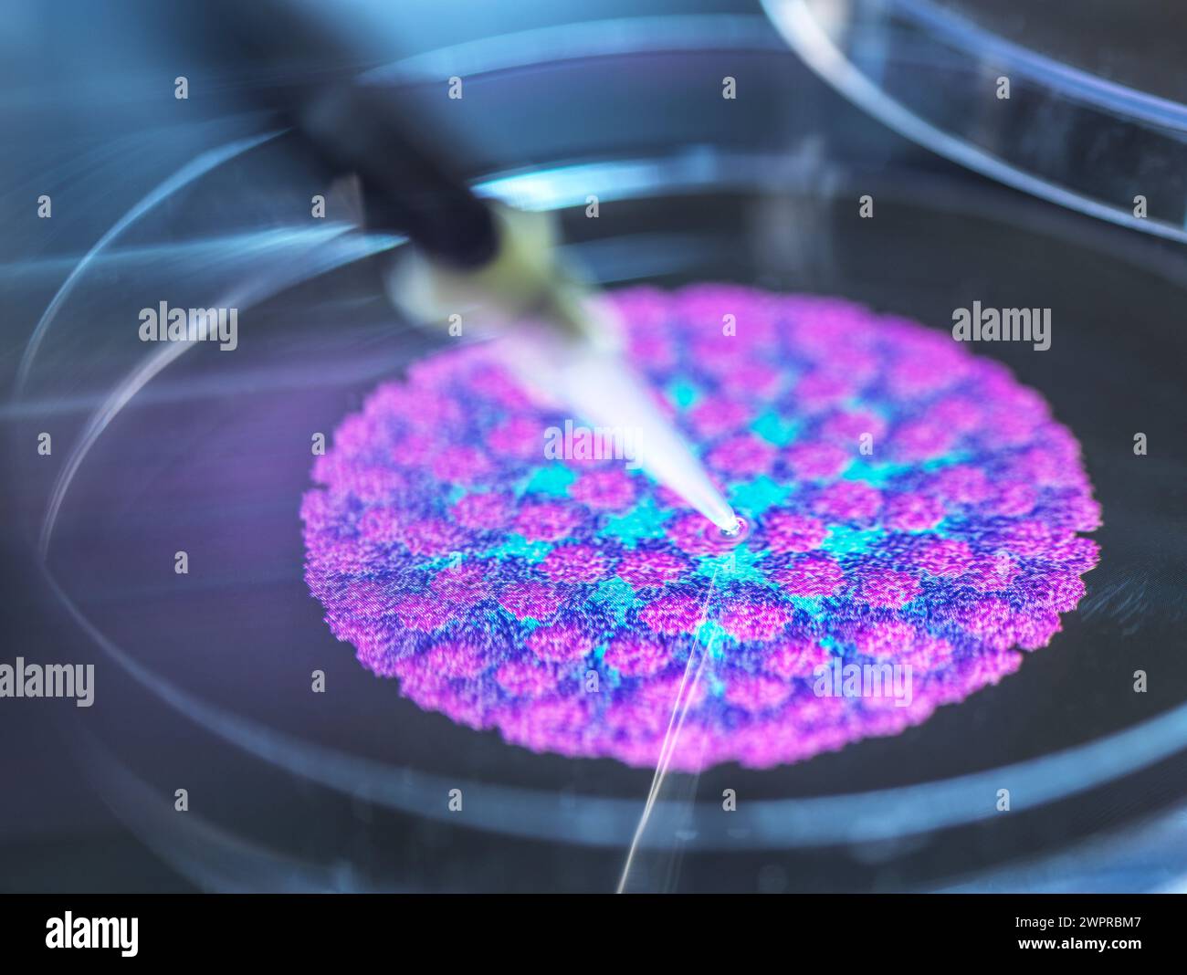 Stomach bug hi-res stock photography and images - Alamy