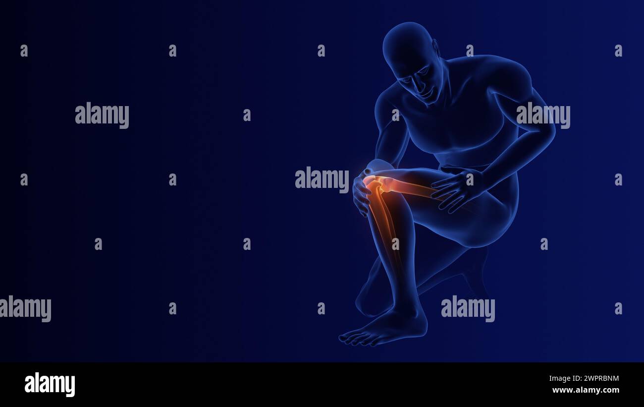 Pain in the leg medical animation Stock Photo - Alamy