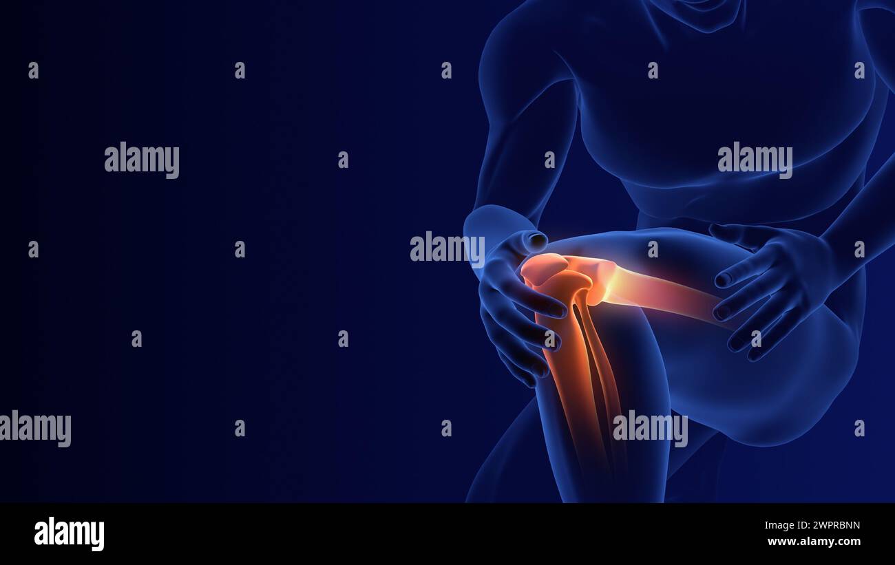 Pain in the leg medical animation Stock Photo - Alamy