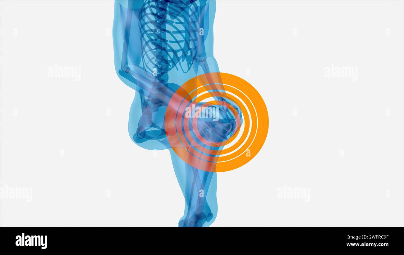 Knee pain, conceptual illustration Stock Photo - Alamy