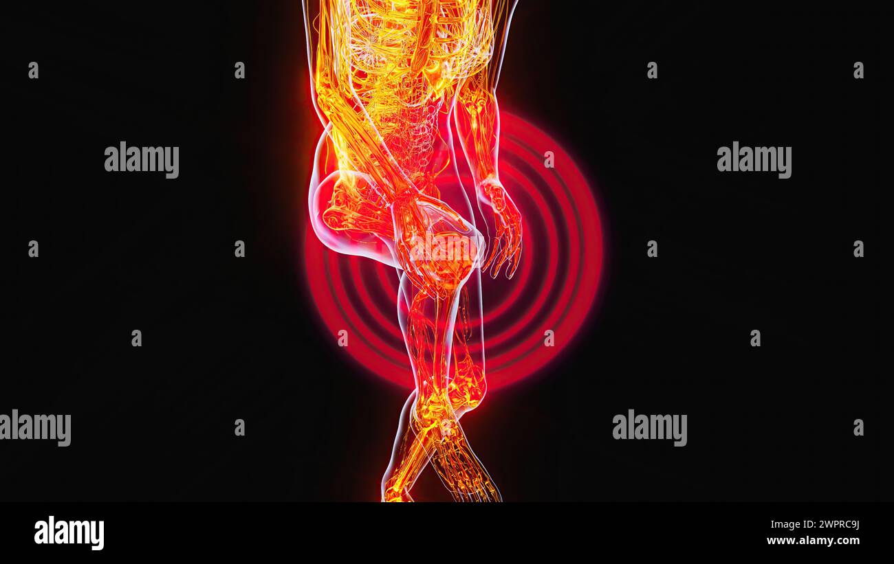 Knee pain, conceptual illustration Stock Photo - Alamy