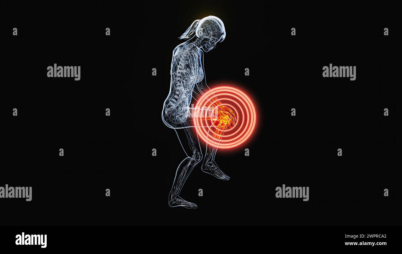 Knee pain, conceptual illustration Stock Photo - Alamy