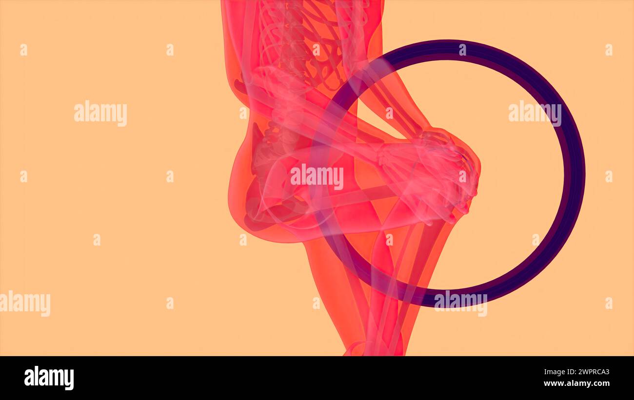 Knee pain, conceptual illustration Stock Photo - Alamy