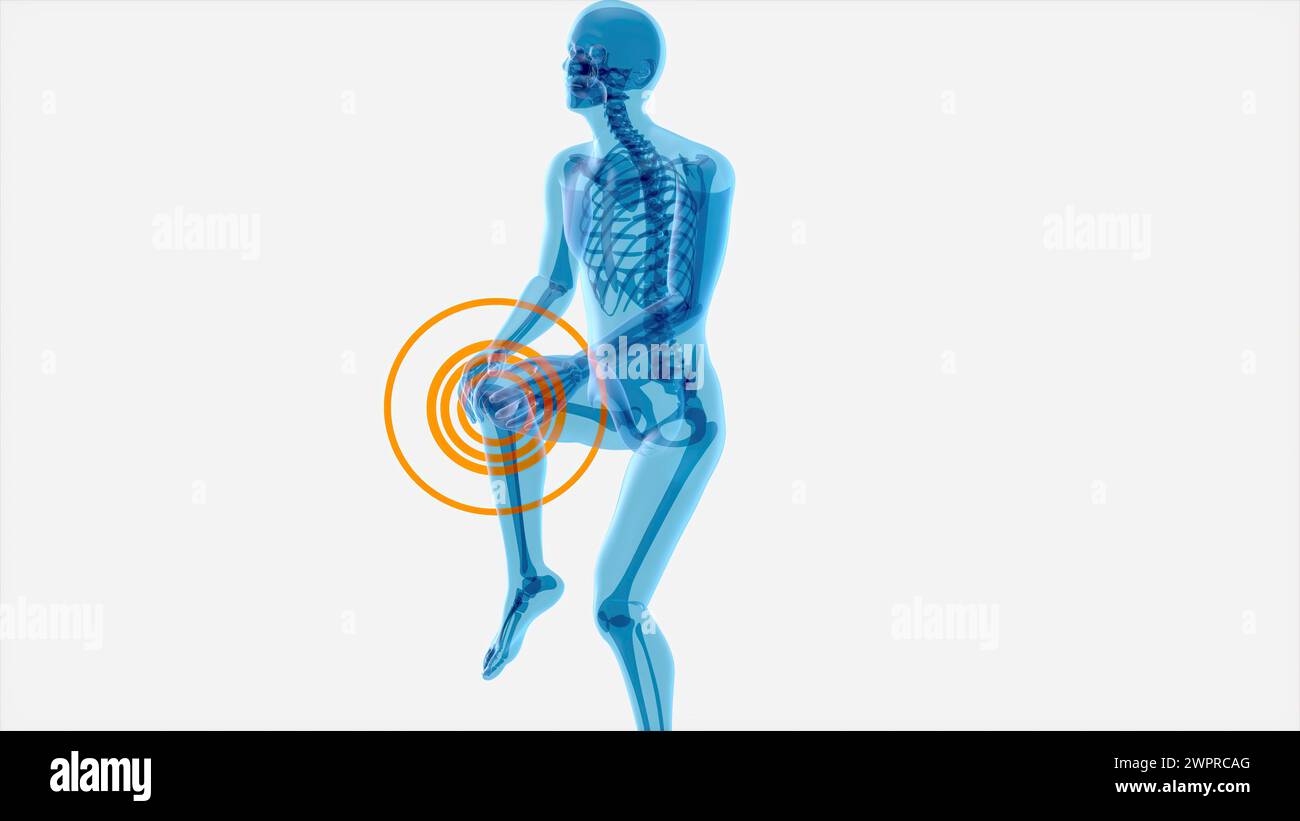 Knee pain, conceptual illustration Stock Photo - Alamy