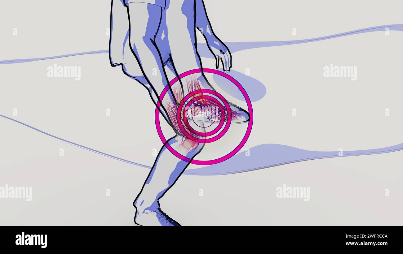 Foot pain, conceptual illustration Stock Photo - Alamy