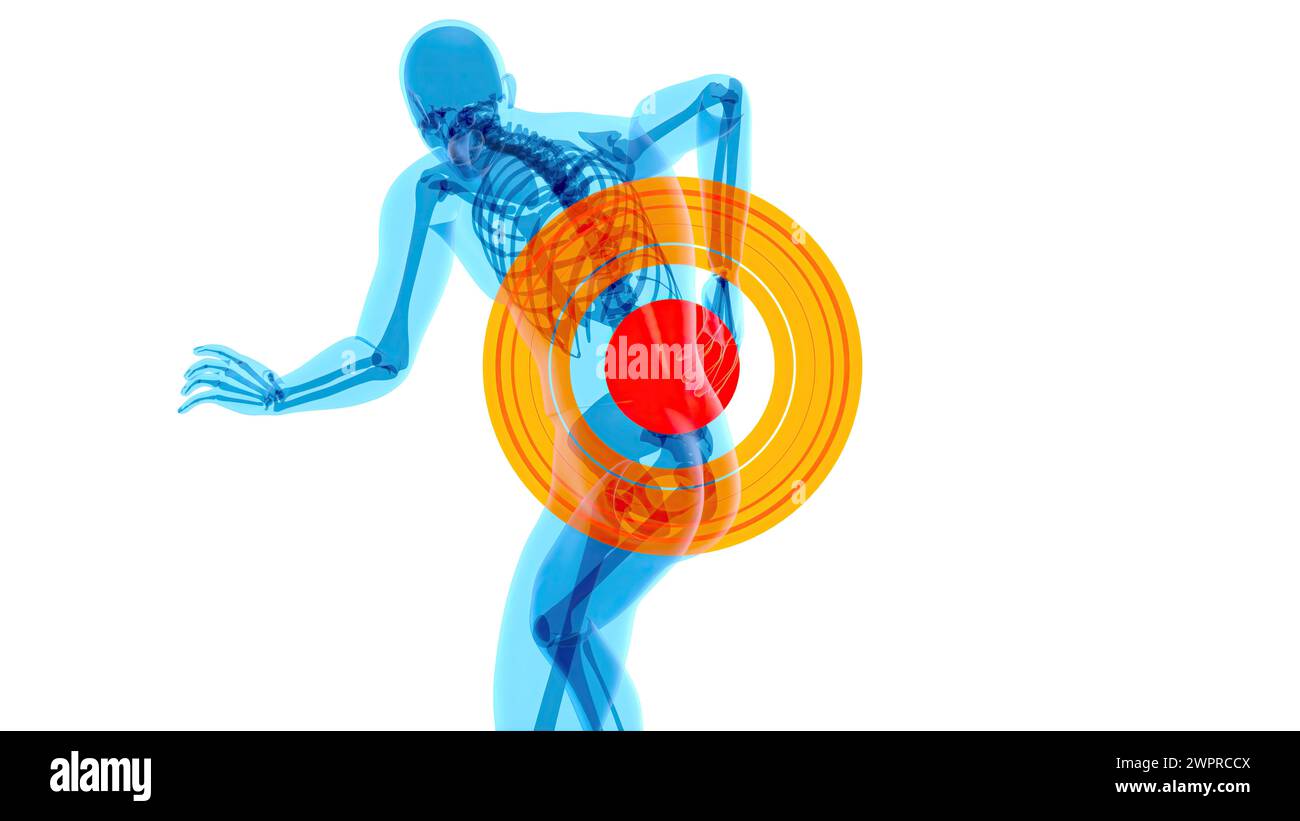 Back pain, conceptual illustration Stock Photo - Alamy