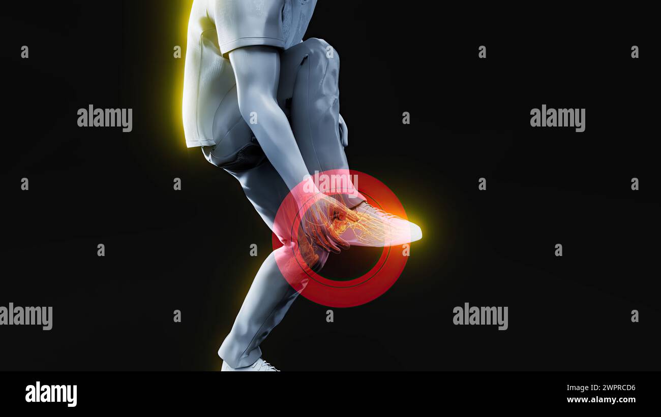 Foot pain, conceptual illustration Stock Photo - Alamy