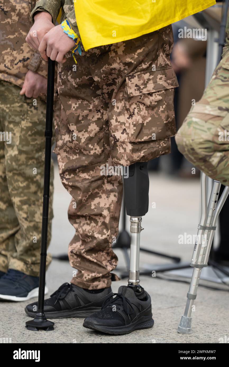 Ukrainian veteran soldier with prosthetic. War in Ukraine. Veteran ...
