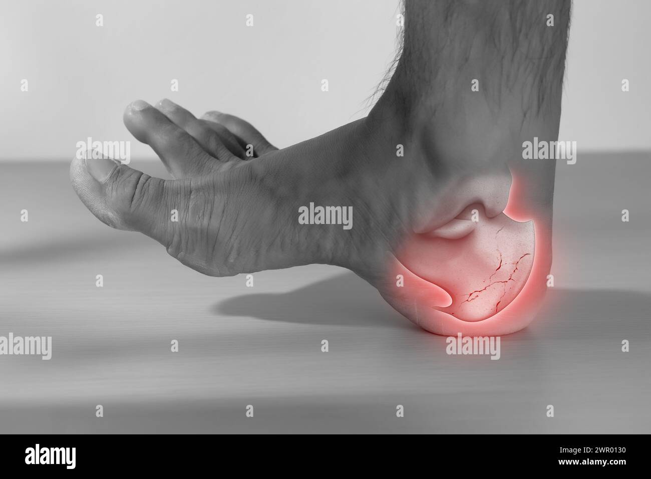 Heel bone hi-res stock photography and images - Alamy