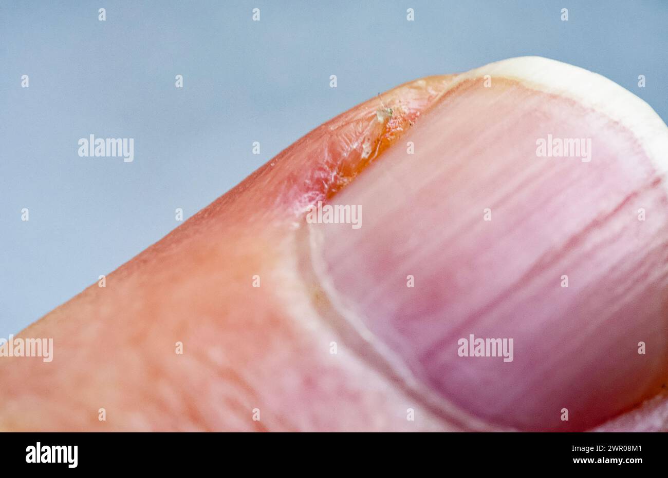 Macro shot of a finger, highlighting the skin and nail Stock Photo - Alamy