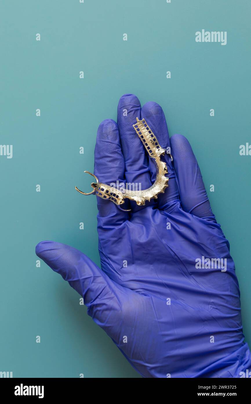 Metal Frame Lower Partial Denture, Cobalt Chrome Dental Plate, Bridge ...