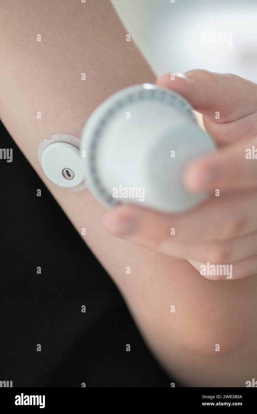 Child holding a setting aid for a glucose sensor, the sensor has been ...