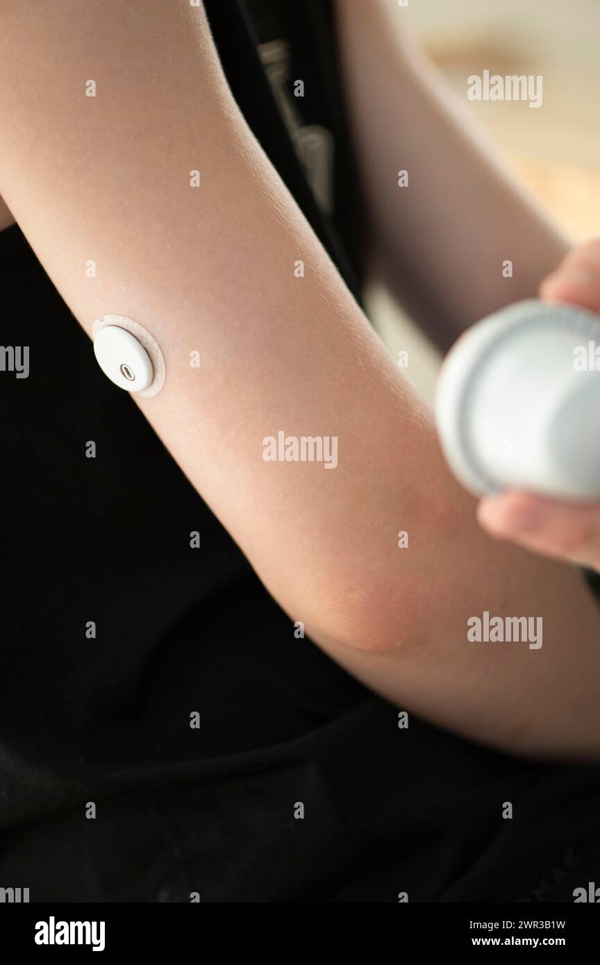 Child holding a setting aid for a glucose sensor, the sensor has been ...