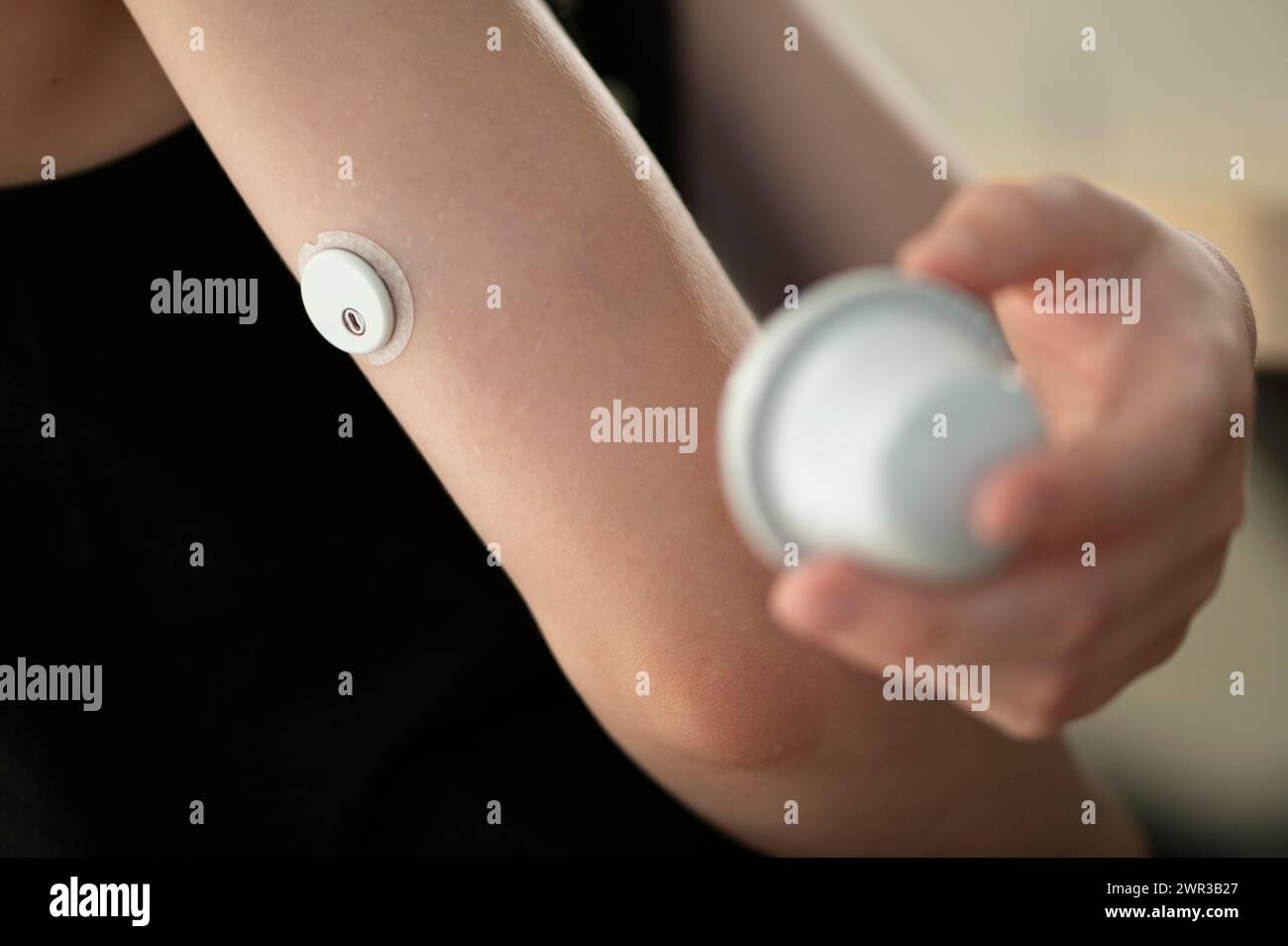 Child holding a setting aid for a glucose sensor, the sensor has been ...