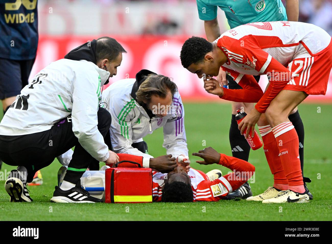 Alphonso Davies Bayern FC Muenchen FCB (19) injured, teeth smashed in ...