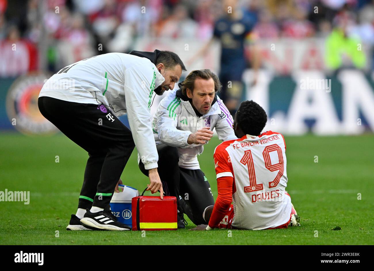 Alphonso Davies Bayern FC Munich FCB (19) injured, teeth smashed in ...