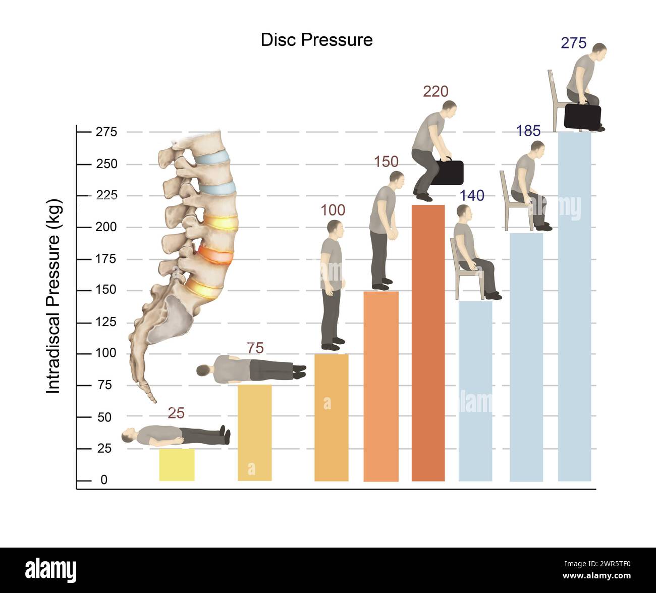 Disc pressure hi-res stock photography and images - Alamy