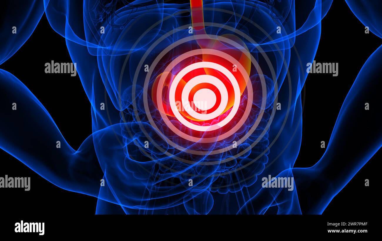 stomach pain anatomy for medical concept 3d illustration Stock Photo ...