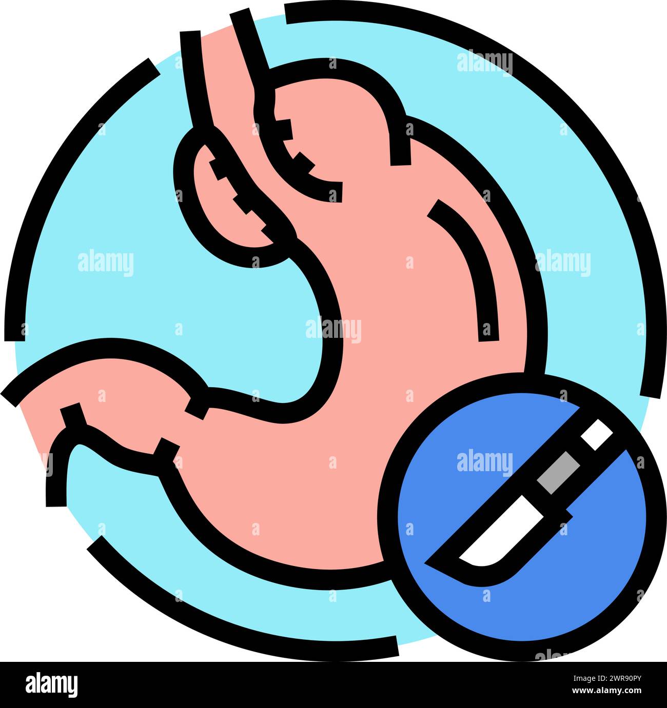 fundoplication surgery color icon vector illustration Stock Vector ...