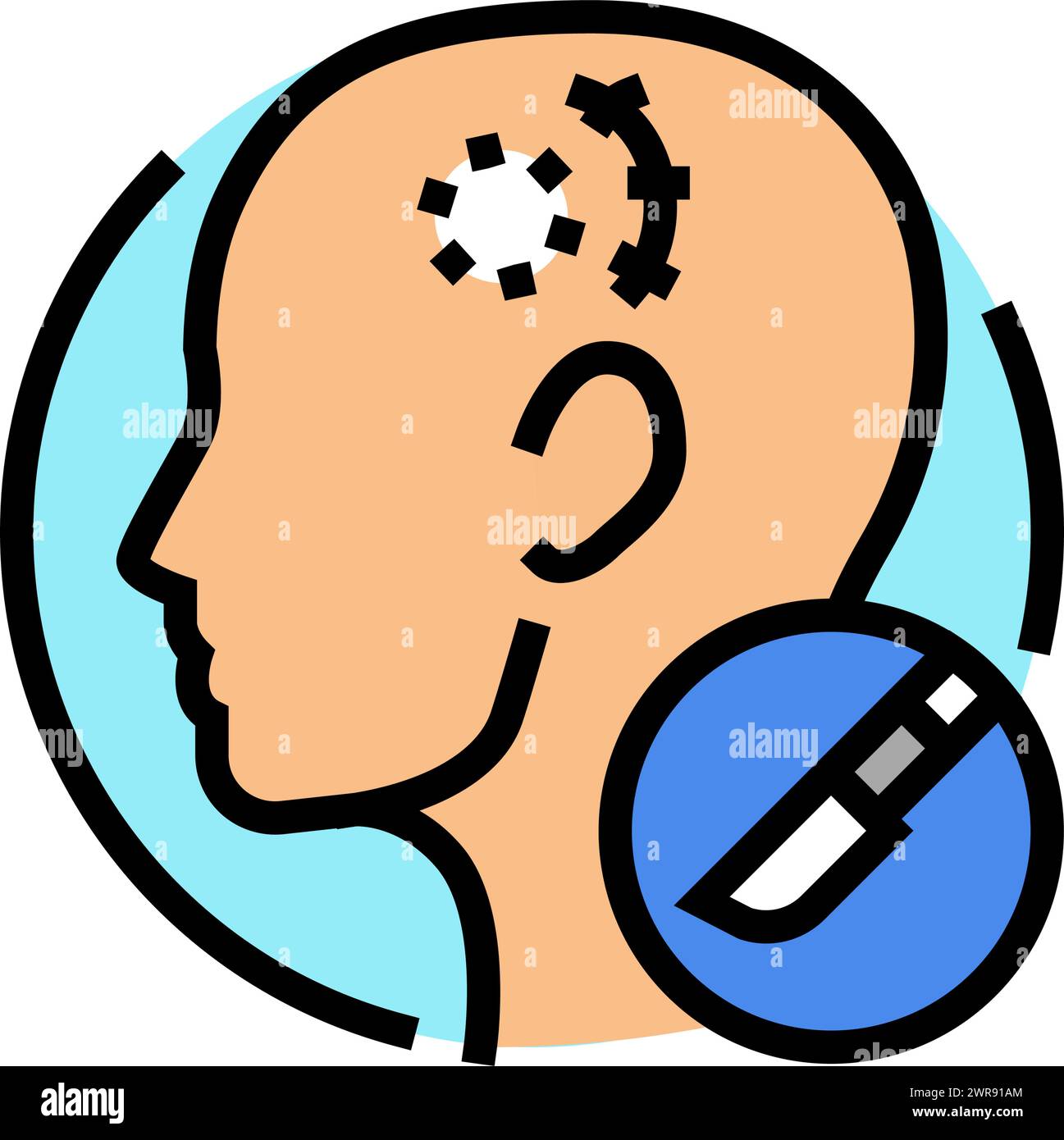 Craniotomy hi-res stock photography and images - Alamy