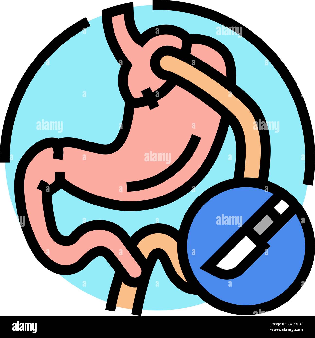 gastric bypass surgery color icon vector illustration Stock Vector ...