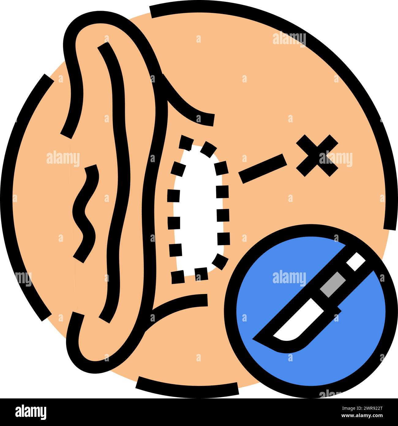 otoplasty surgery color icon vector illustration Stock Vector Image & Art - Alamy