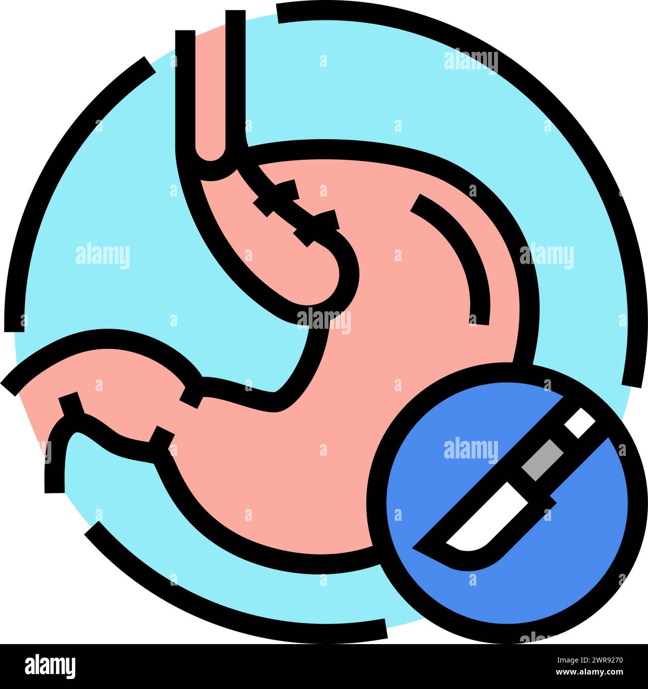 nissen fundoplication surgery color icon vector illustration Stock ...