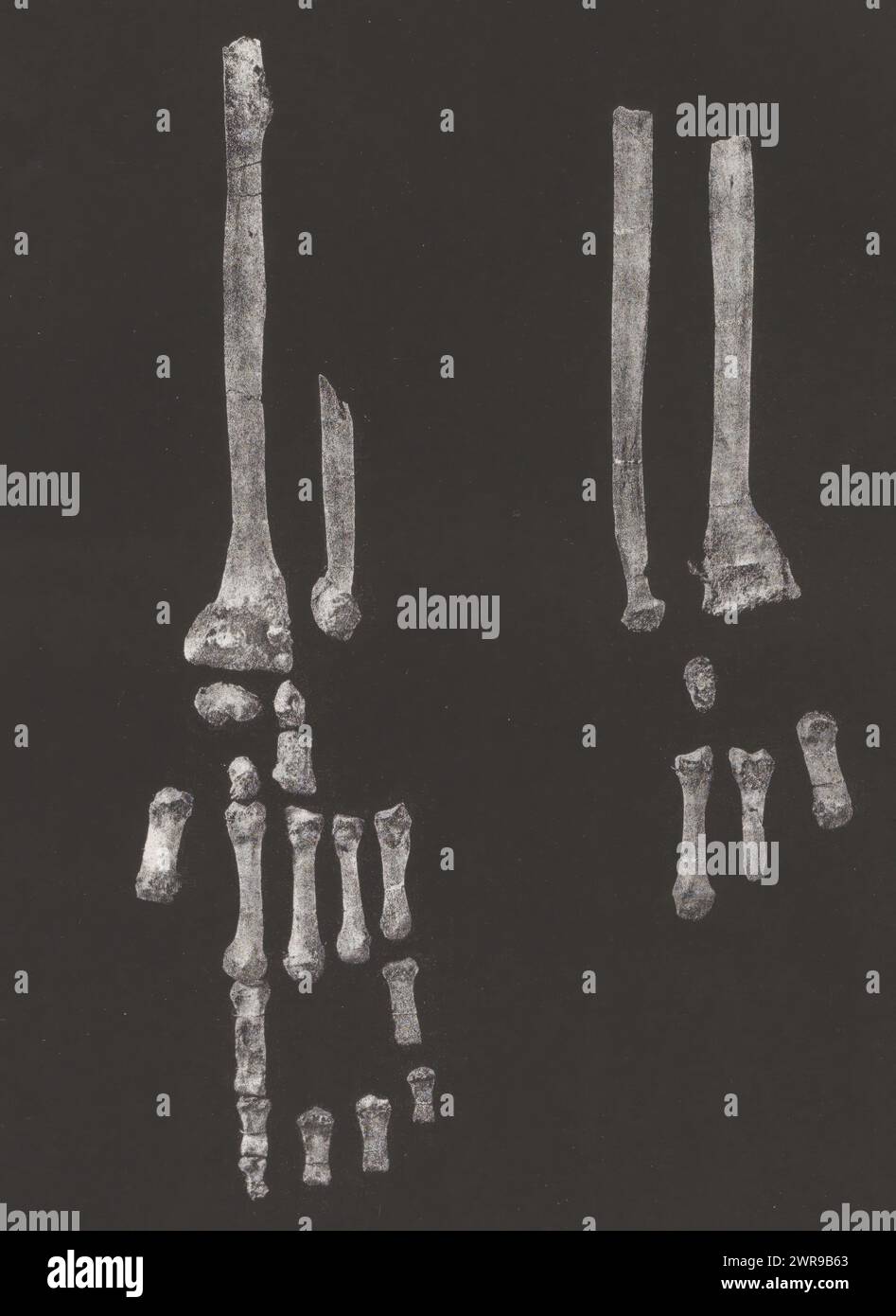 Radius et ulna hi-res stock photography and images - Alamy