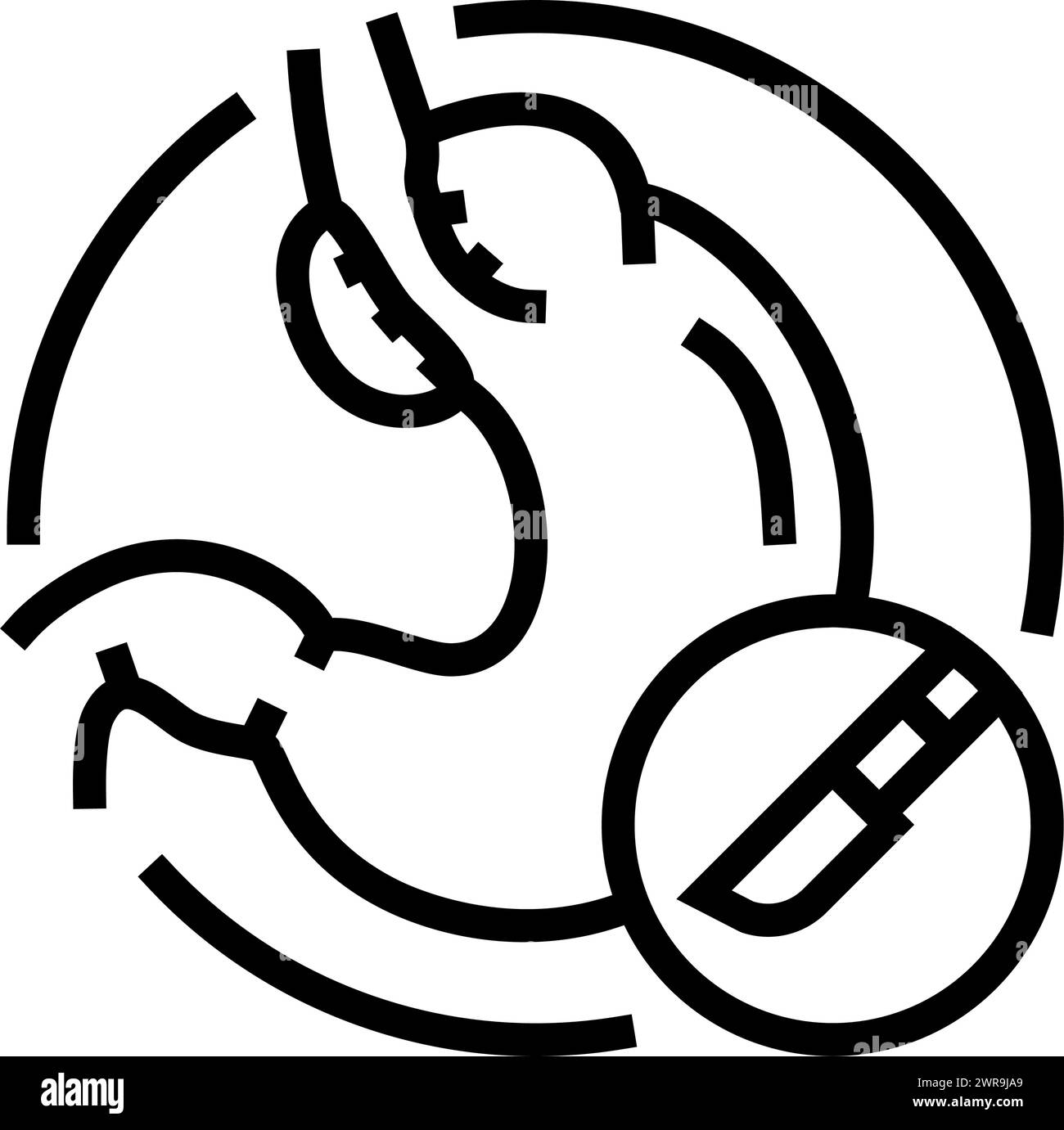 fundoplication surgery line icon vector illustration Stock Vector Image ...