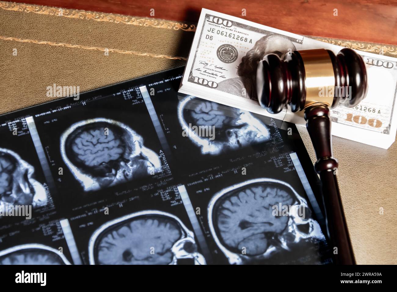 A concept image depicting MRI brain scans overlaid with a judge's gavel ...