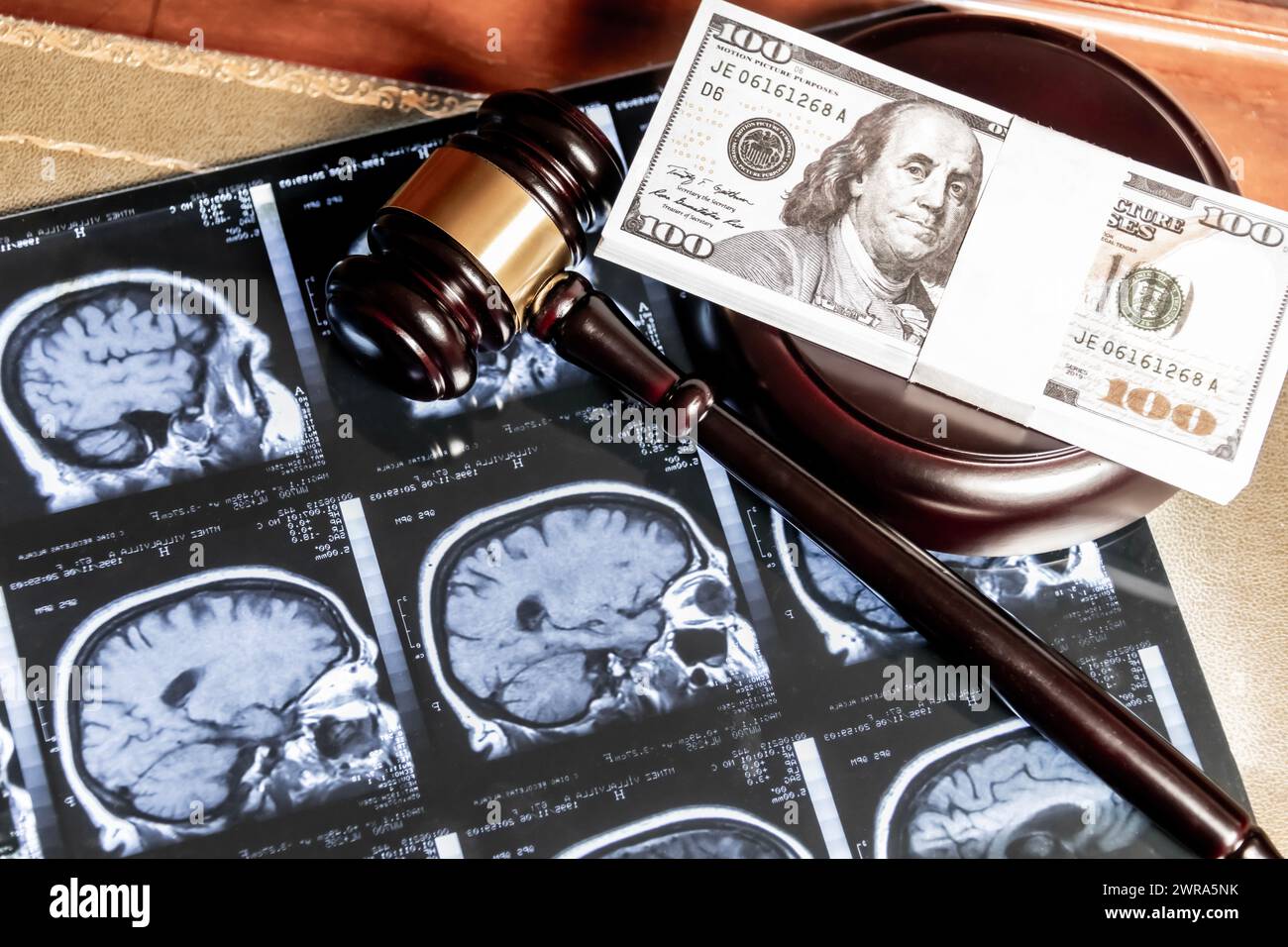 A concept image depicting MRI brain scans overlaid with a judge's gavel ...