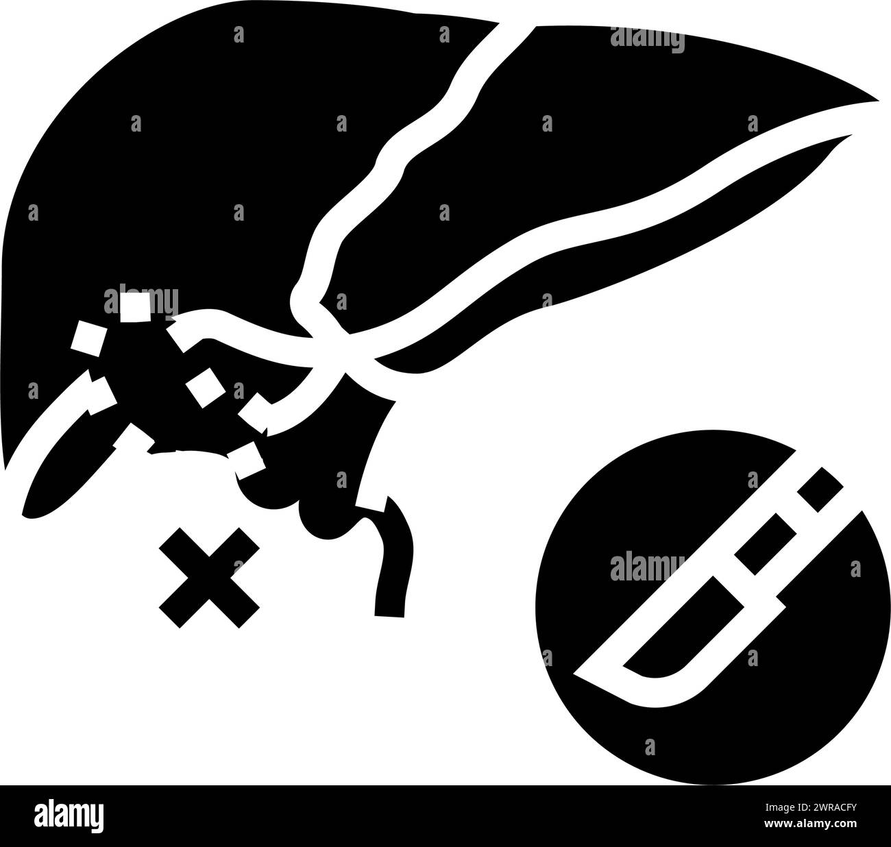 cholecystectomy surgery glyph icon vector illustration Stock Vector ...