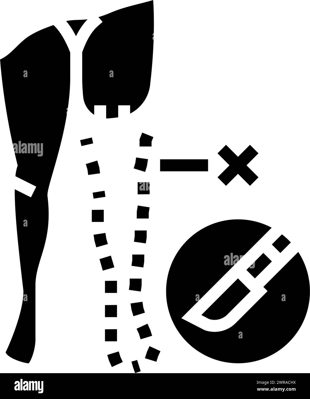 Medicine surgery amputation leg amputation Stock Vector Images - Alamy