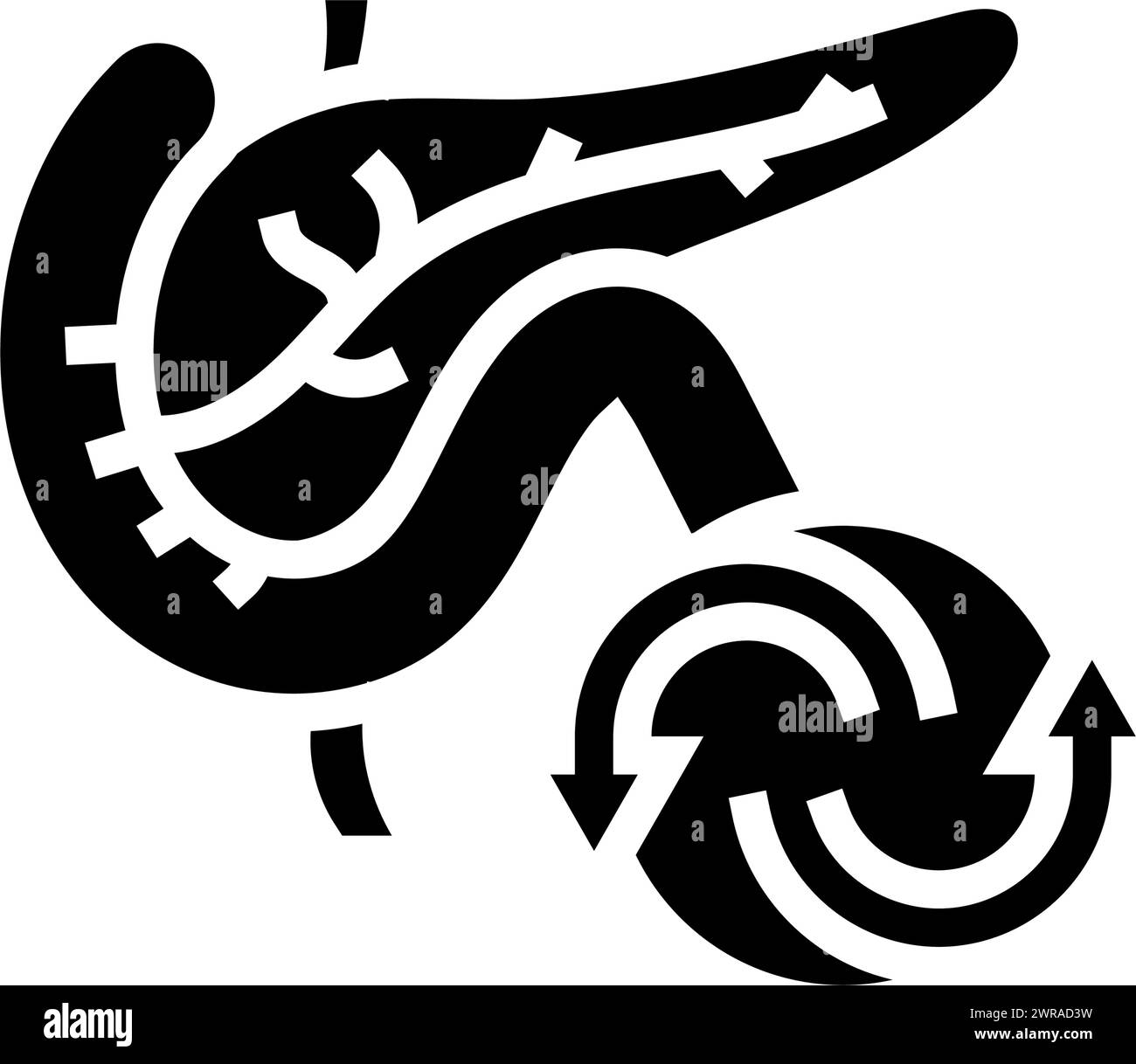 pancreas transplant surgery glyph icon vector illustration Stock Vector ...