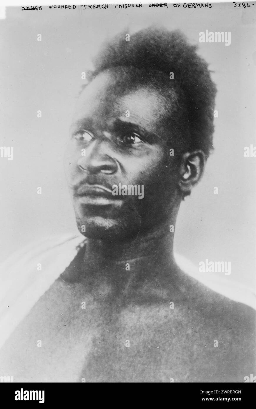 Wounded 'French' prisoner of Germans, Photograph shows a African ...