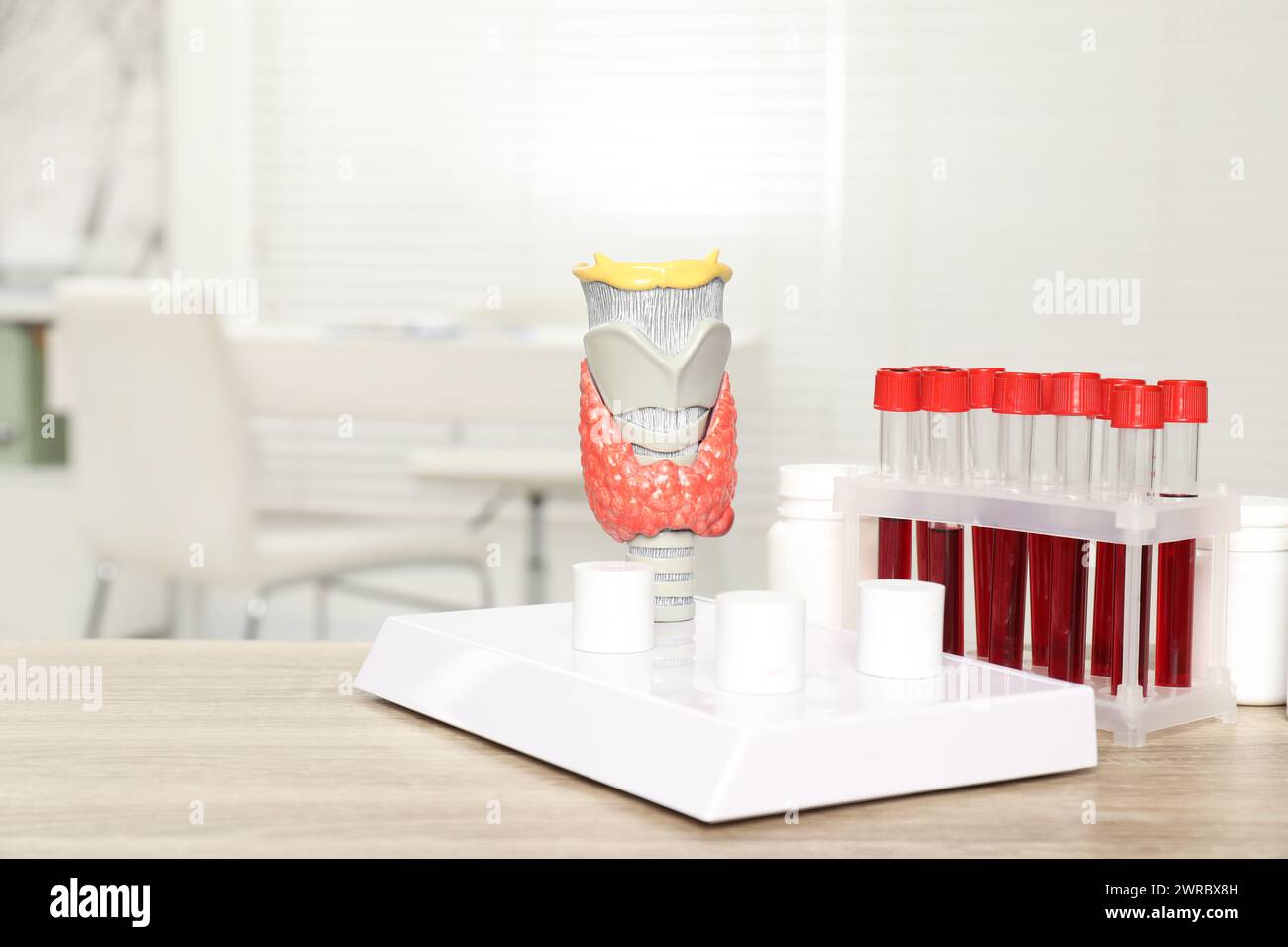 Endocrinology. Model of thyroid gland and blood samples in test tubes ...