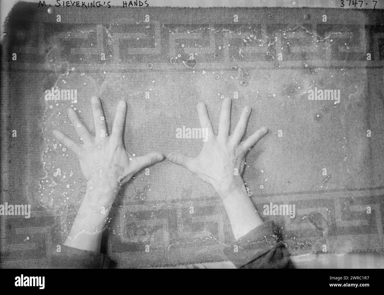 Sievekings hands hi-res stock photography and images - Alamy