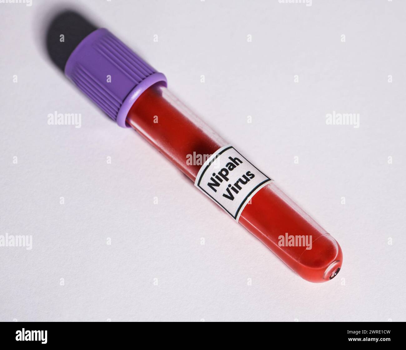 Pig blood sample hi-res stock photography and images - Alamy