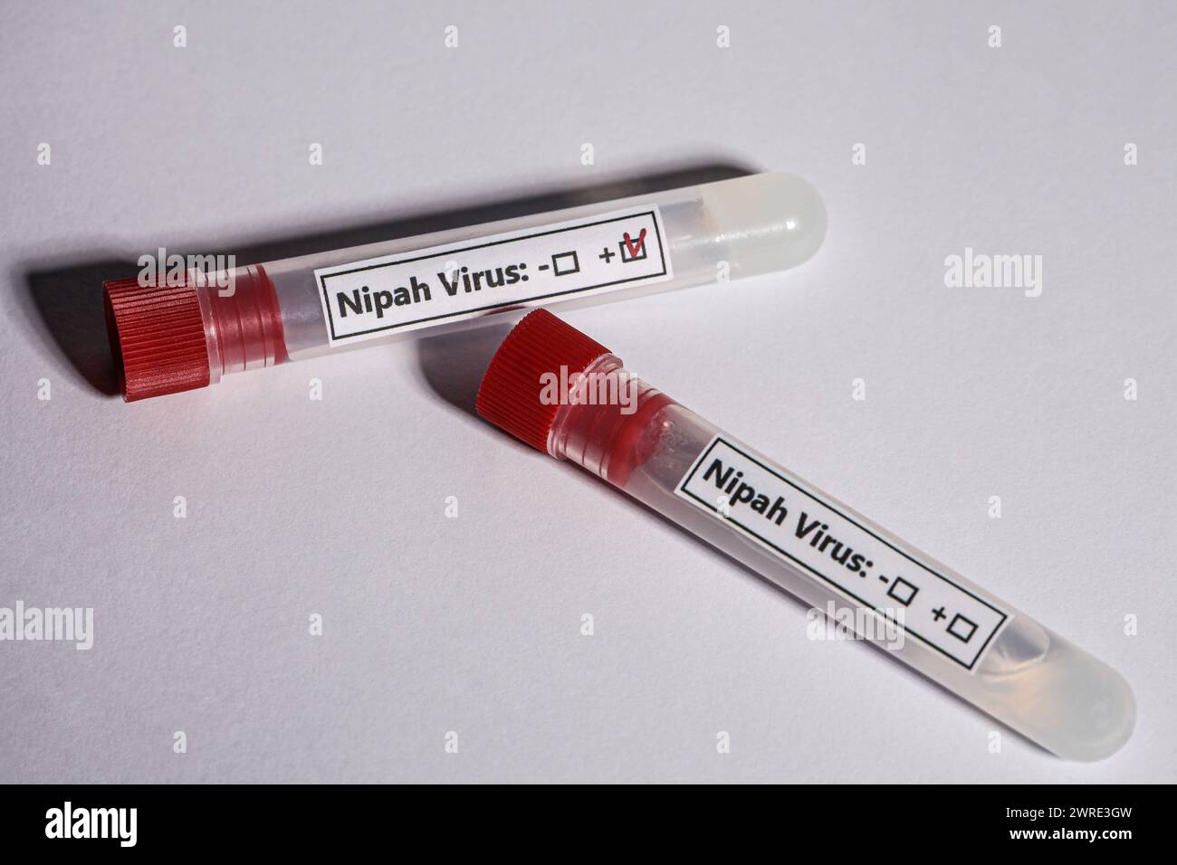 In the picture on a white background, two test tubes with the Nipah ...