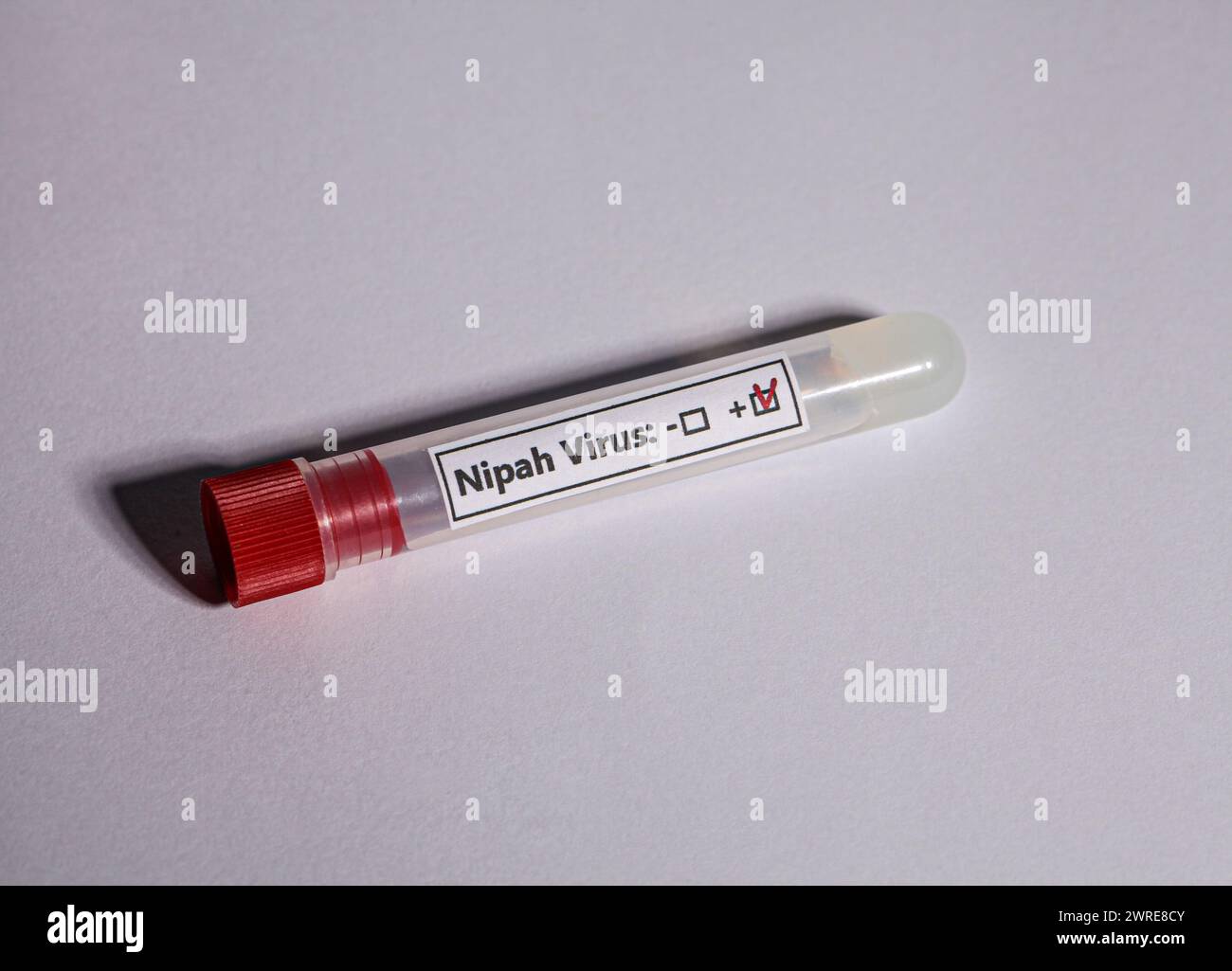 A picture with a white background and a transparent test tube has the ...