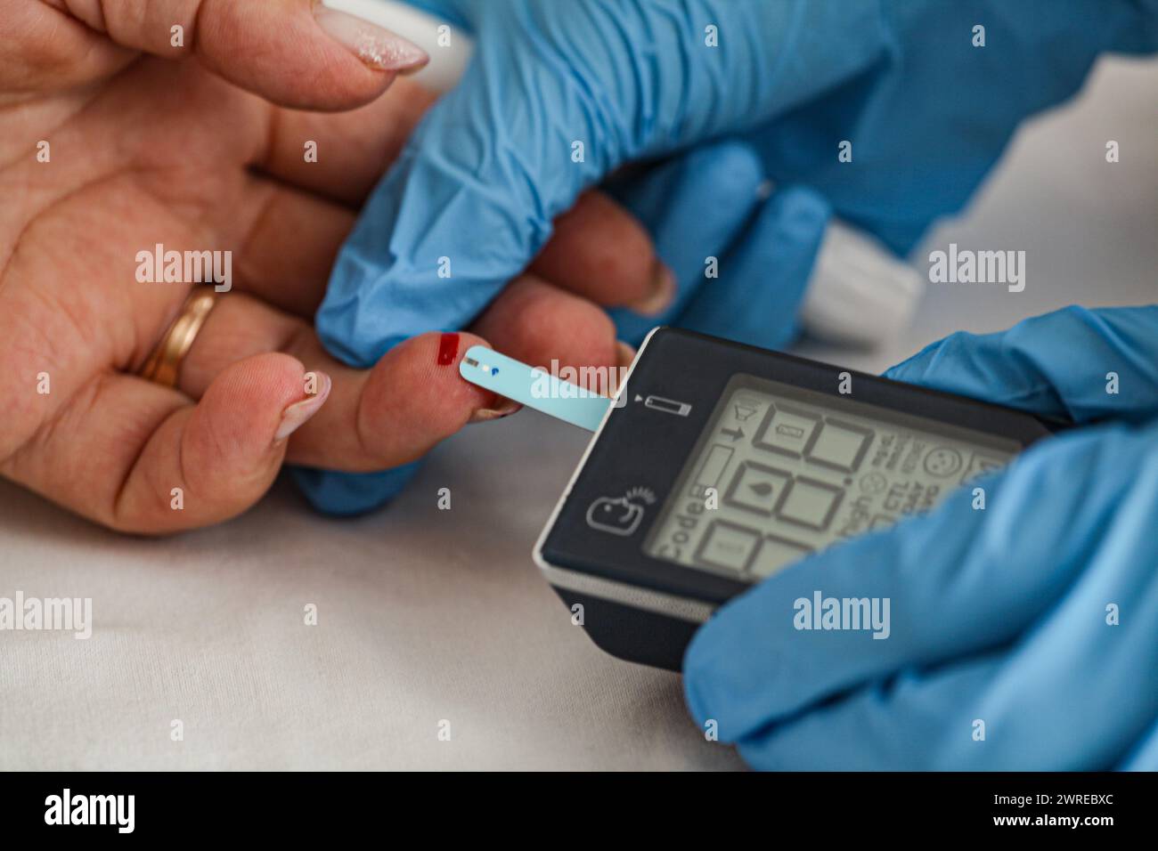 Doctor checking blood sugar level with glucometer. Treatment of ...